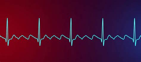Atrial Flutter Stock Photos Royalty Free Atrial Flutter Images Depositphotos