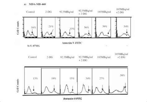 Effects Of 2 Dg On 99 Mtc 925 Mbqml And 185 Mbqml Induced