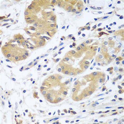 Complement Factor D Antibody Pa5 87050
