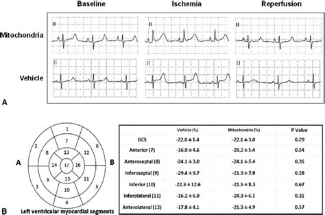 A Electrophysiological Data Representative Electrocardiograms At Download Scientific Diagram