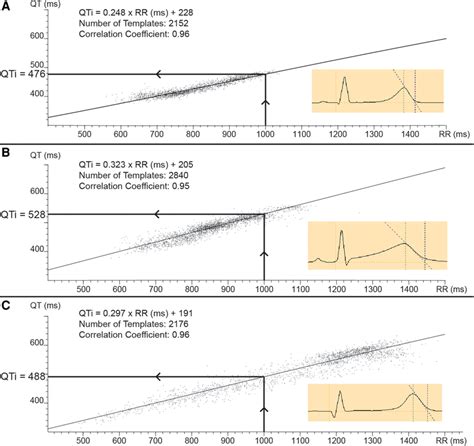 illustration of the methodology of individualized qt correction qti