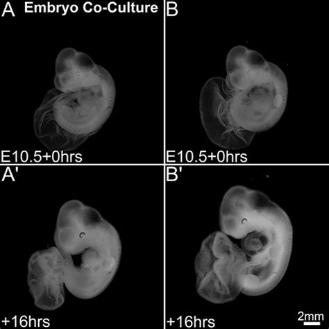 Mouse Embryonic Development In A Serum Free Whole Embryo Culture System