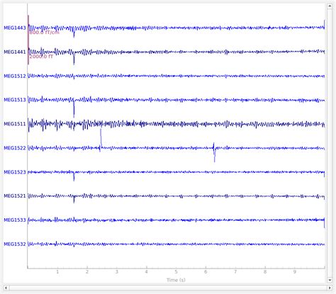 plot sensor denoising using oversampled temporal projection — mne 1 7 1