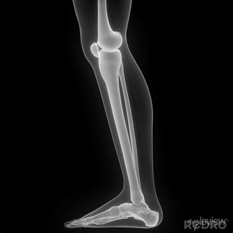 Lateral View Of Human Skeleton Tibia And Fibula Anatomy X Ray • Wall
