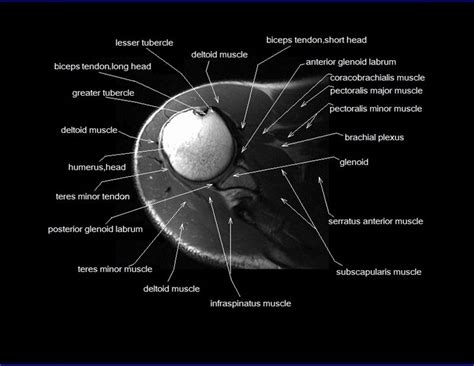 Axial Shoulder Anatomy Imaging Anatomy