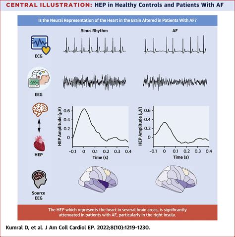 Attenuation Of The Heartbeat Evoked Potential In Patients With Atrial Fibrillation Jacc
