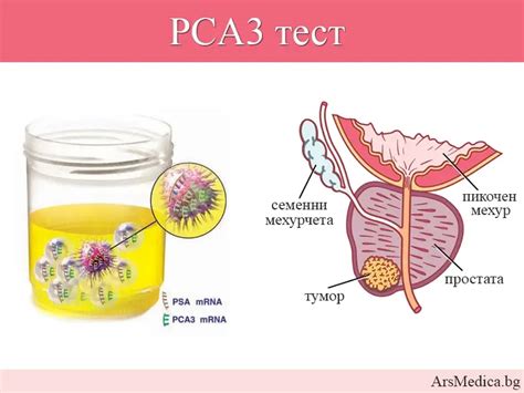 Mchc средна концентрация на хемоглобин в еритроцитите Arsmedica Bg