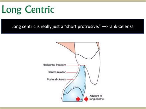 Centric Relationpptx
