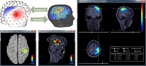 Brainstorm A Matlab Based Open Source Application For Advanced Meg