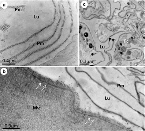 Transmission Electronic Micrographs Of The Peritrophic Membrane From Download Scientific