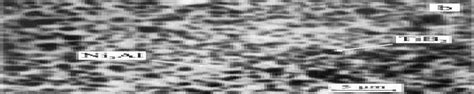 Characteristic Microstructures Of Ni 3 Al Tib 2 Composite Synthesized