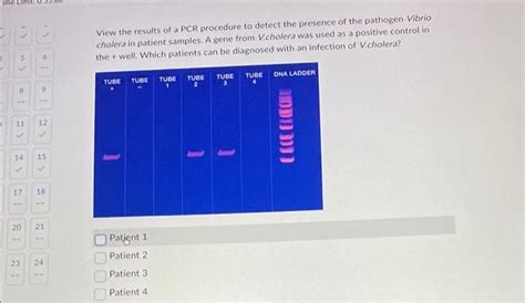 View The Results Of A Pcr Procedure To Detect The