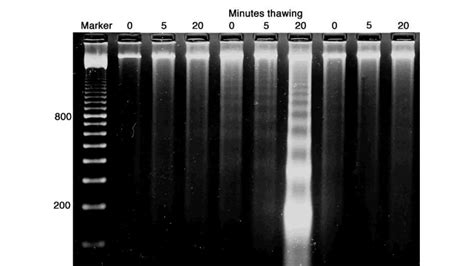 Pcr Polymerase Chain Reaction And Extraction Of Dna From Fungal Plant