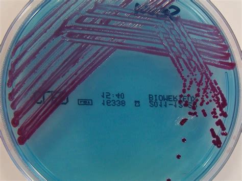 Reproduction Of Protists And Bacteria By Vsk3234