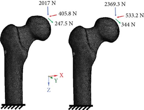Meshing And Boundary Conditions A Meshed Model Of Proximal Femur Download Scientific