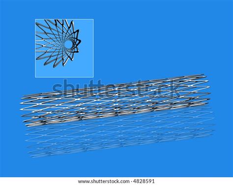 1 Coronary Artery Bypass Multiple Royalty Free Photos And Stock Images