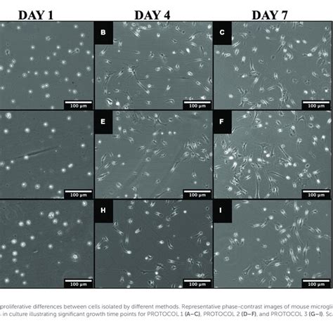 Overview Of Protocols For Microglia Isolation A Schematic Download Scientific Diagram