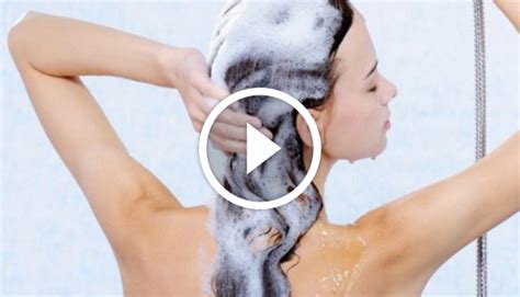 Top 10 Medicines To Control Dandruff