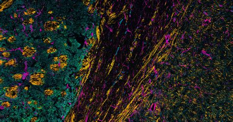 From Image To Results Enabling 3d Multiplexing Spatial Omics