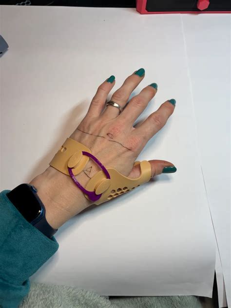 Right Thumb Brace Cmc Mcp By Familiekp Makerworld Download Free 3d Models