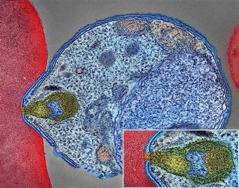 Histamine Releasing Factor Makes Host Vulnerable To Malaria