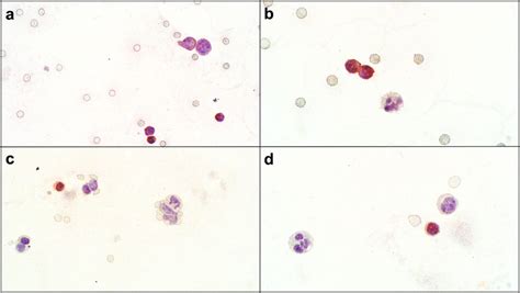 Immunocytochemistry Icc Of Abdominal Effusion Fluid Collected At Download Scientific Diagram