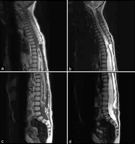 Surgical Neurology International