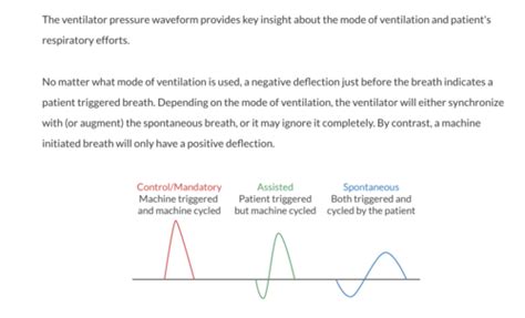 Apex Equipment And Monitors Original Flashcards Quizlet