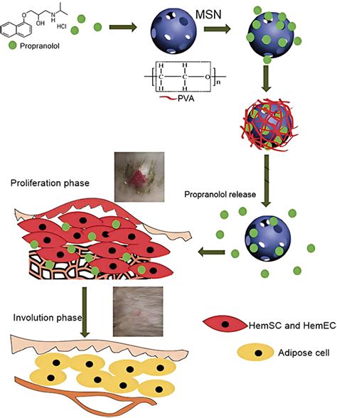 Recent Advances In Propranolol Hydrochloride Formulations For The Trea Dddt