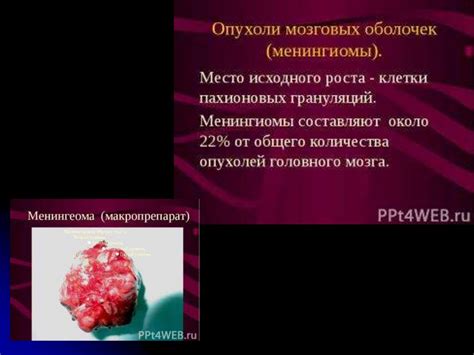 Опухоли меланинобразующей ткани. Опухоли нервной системы и оболочек ...