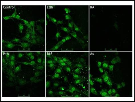 Figure 15 From Expression Patterns Of The Major Vault Protein Mvp And Cellular Vault Particles