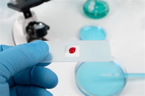 Exploring Hiv Test Kit Types A Comprehensive Guide