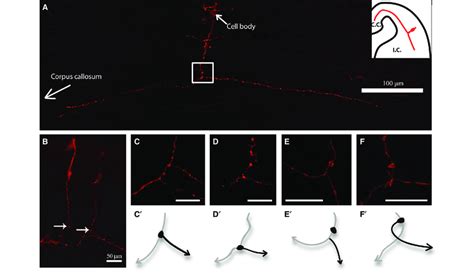Retrograde Tracing From Corpus Callosum At E18 5 Labels Cortical Download Scientific Diagram