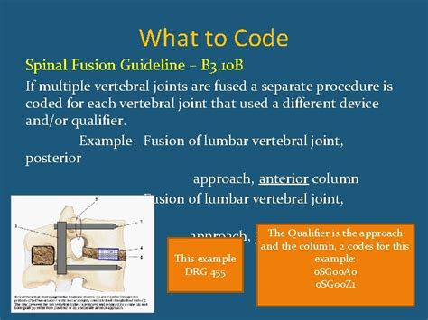 Spinal Procedure Coding In Icd 10 Linda Dawson