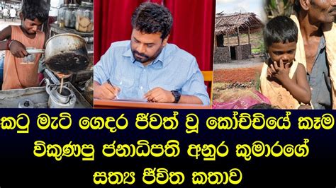 උපන්දා පටන් ගිනිගොඩක ජීවත් වූ අනුර කුමාරගේ ඇඟ කිලි පොලා යන ජීවිත කතාව Youtube