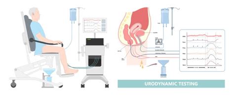 Urodynamics Testing For Bladder Function North Texas UPNT