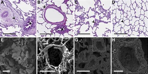 A Morphomolecular Approach To Alveolar Capillary Dysplasia The