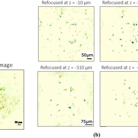 Schematic Representation Of Light Field Microscopy With Correlated Download Scientific Diagram