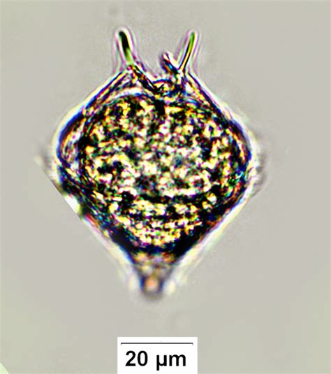 Protoperidinium