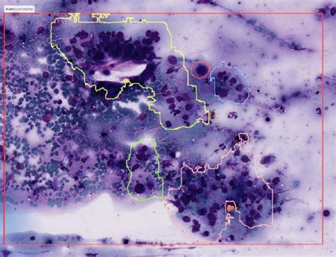 an example of model predictions for tumor cell detection and type