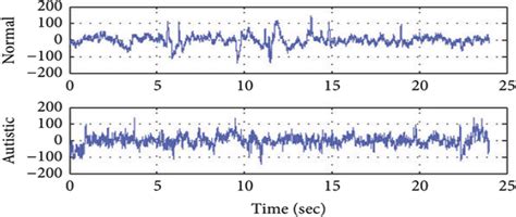 Examples Of Raw Normal Eeg Signals And An Autistic Eeg Signal Djemal Download Scientific
