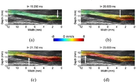 Figure 1 From Finite Element Modeling Of The Pulse Wave Propagation In