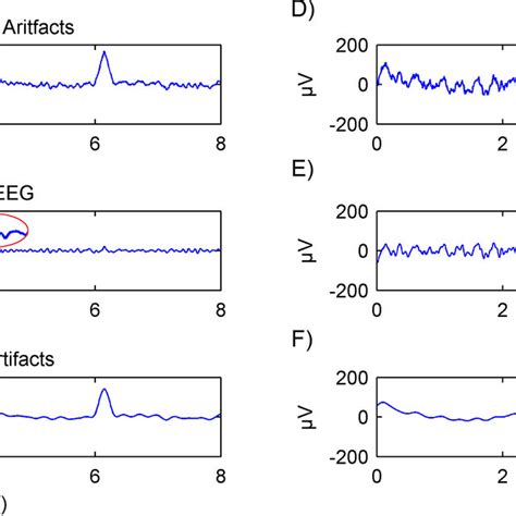 Results Of The Alpha Rhythm Extraction From Simulated Eeg Data Using