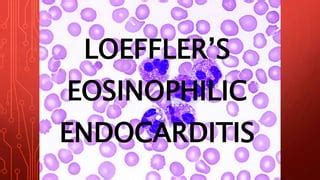 Loefflers Endocarditis Pptx