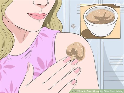 4 Ways To Stop Mosquito Bites From Itching WikiHow