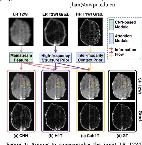 Figure 1 From Cross Modality High Frequency Transformer For Mr Image Super Resolution Semantic
