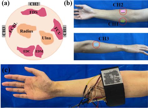 Figure 11 From A Layered Semgfmg Hybrid Sensor For Hand Motion Recognition From Forearm Muscle