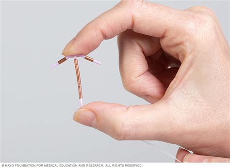 Copper Iud Paragard Beacon Health System