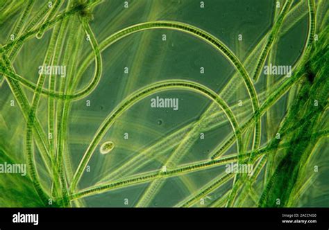 Light Micrograph Of The Filamentous Blue Green Algae Oscillatoria Sp A Small Ciliate Protozoan