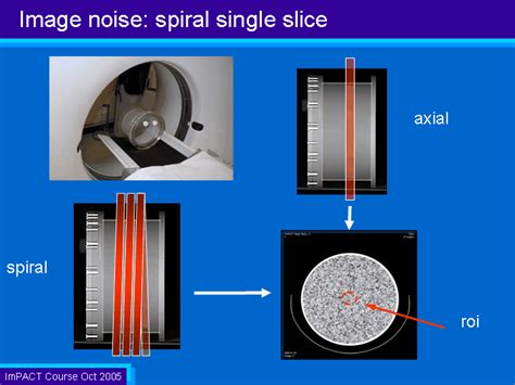 image noise spiral single slice